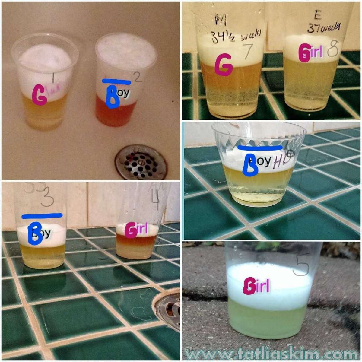 İdrarla Cinsiyet Belirleme Yöntemi - Hamilelikte İdrar Rengi - Tatlı ...